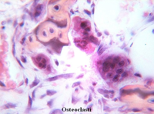 Celula Osteoclastica